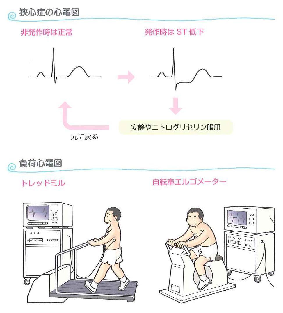 心電図クイズ 【問題10】 難易度 ★｜かんかん！ 看護師のためのwebマガジン By 医学書院
